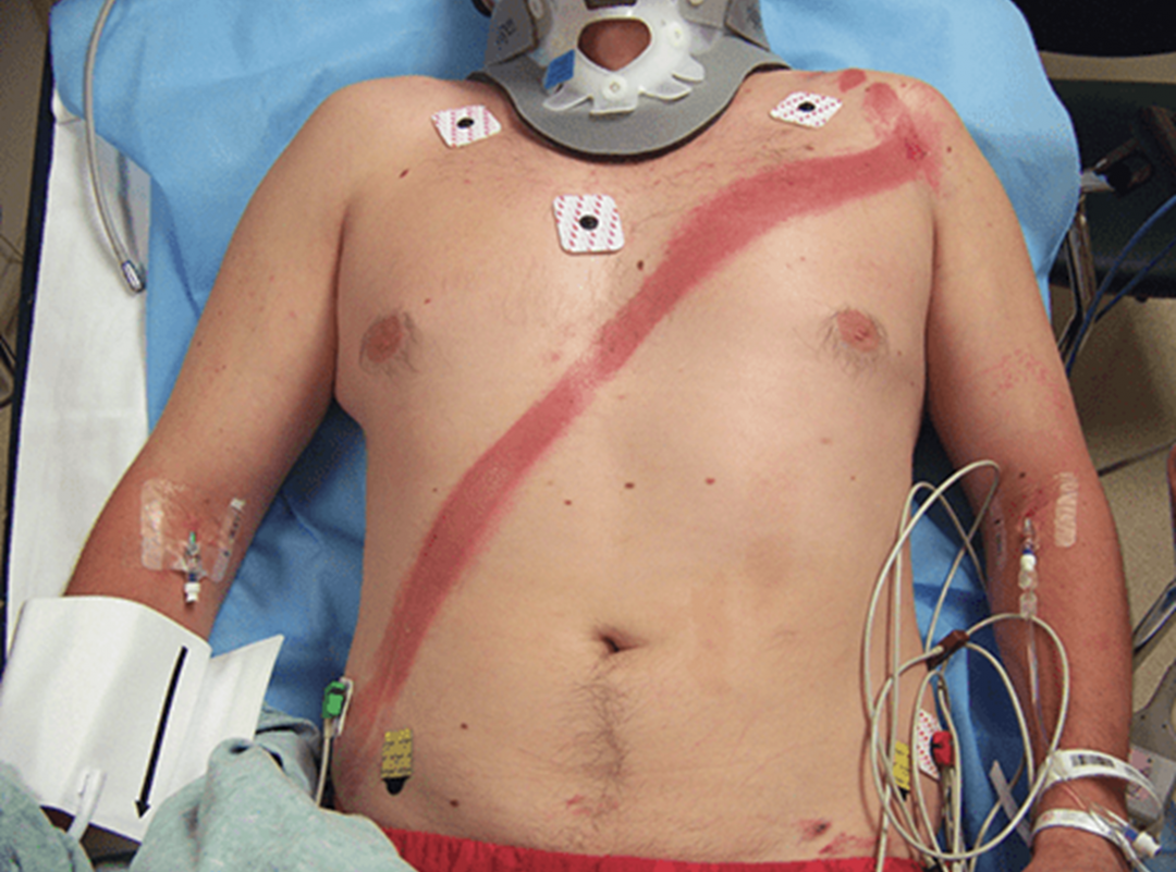 Trauma Season: Occult Injuries - Summit Professional Education