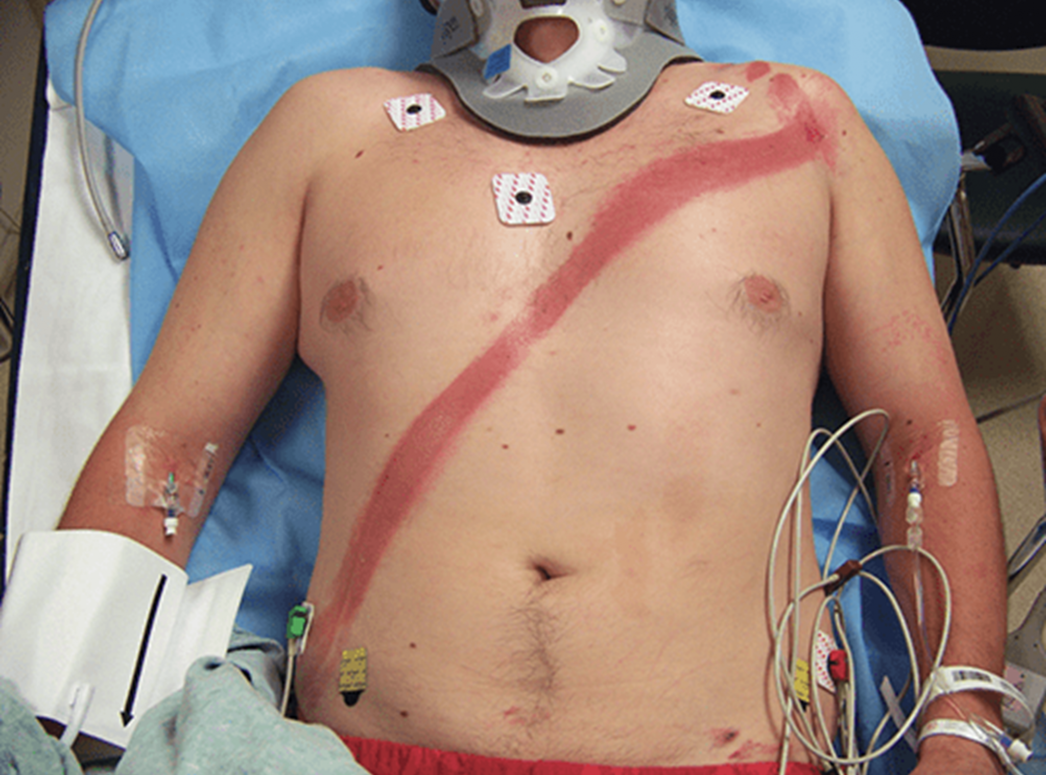 Trauma Season: Occult Injuries - Summit Professional Education